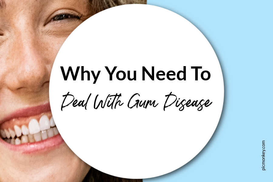 Why You Need To Deal With Gum Disease Immediately ...